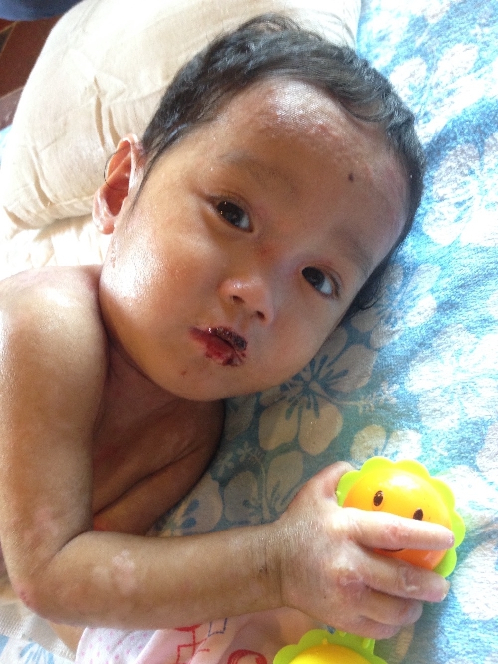 Fundraiser by Rachel Van Zetten : Srey Ya's Medical Fund