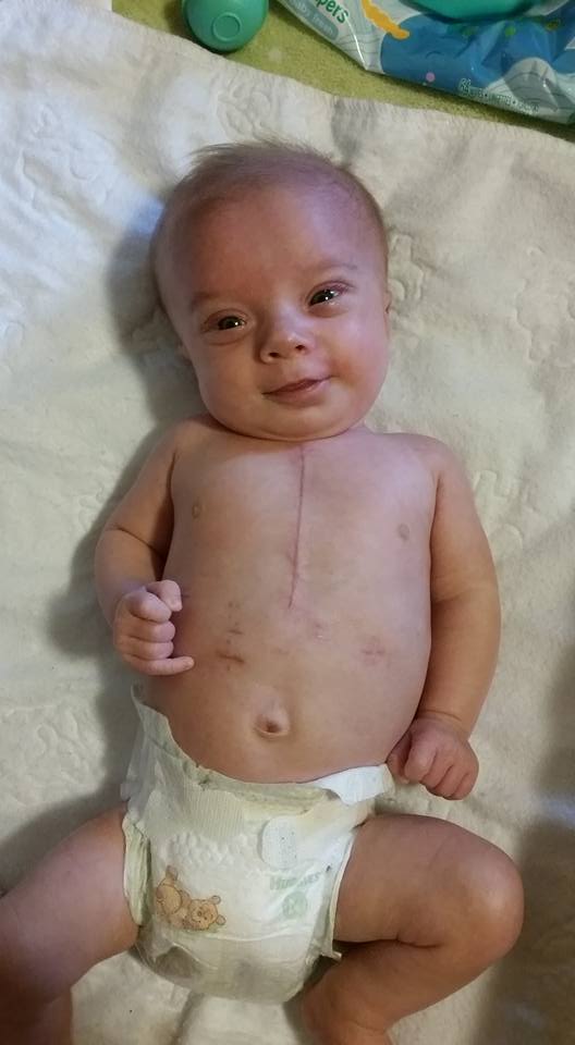 Fundraiser by Amy Greth : Levi's Healing Heart Fund