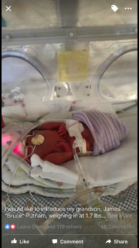 Fundraiser for Blake Putnam by Sandra Trull : Help Baby Bruce