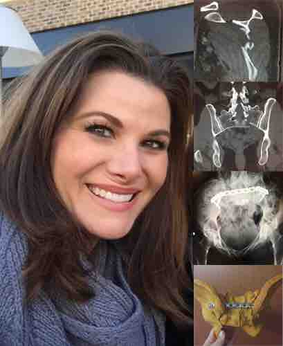 Fundraiser for R. Brennon Simmons by Gabe Hoffman : Patti Simmons ...