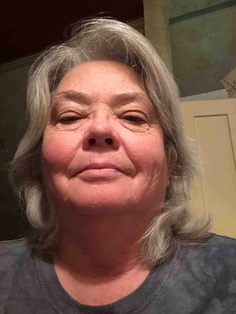 Fundraiser by Rebecca Beech : Rebecca Beech Has Kidney Cancer