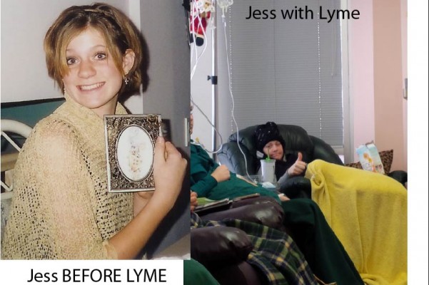 Fundraiser by Jessica Clutterbuck : Help Jess Cure her Lyme Disease