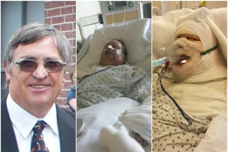 Fundraiser for Nancy Booth by Nancy Davis Domgaard : Jay Davis' Bad Burns