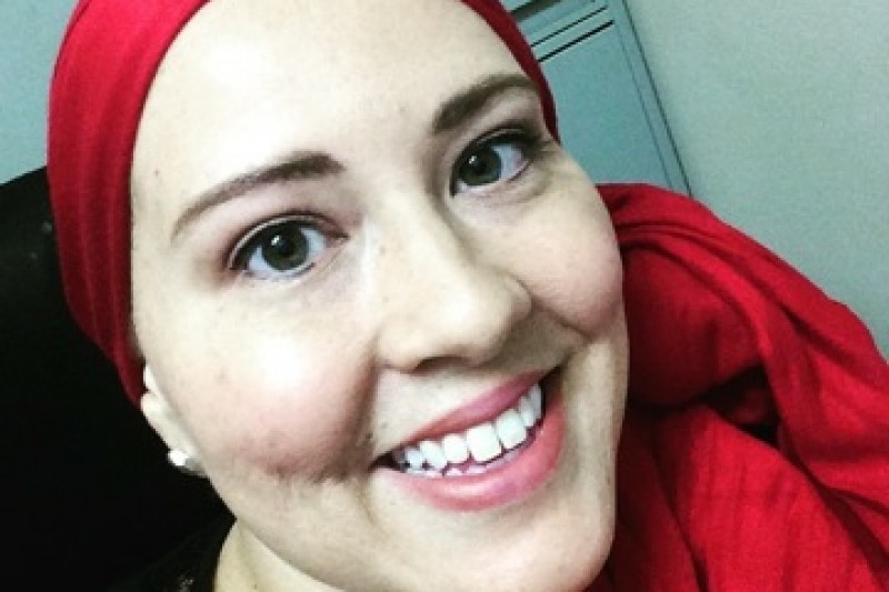 Fundraiser for Alison Collier by Mary Hankinson Dingman : Alison's ...