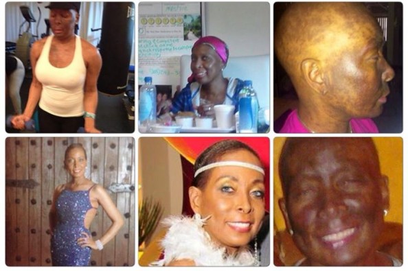 Fundraiser by Suzanne Ferguson : Bone Marrow Survivor/Thriver Fund