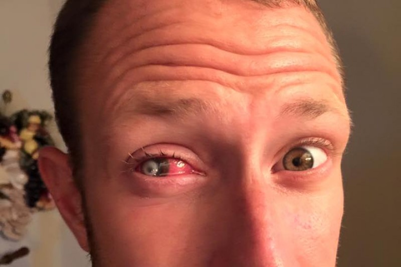 Fundraiser by Catherine Musselman : Help Nate Musselman See Again!