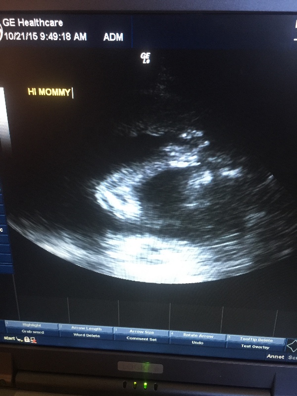 Fundraiser by Morgan Deitle : Travel/Medical Expenses - Baby Jace