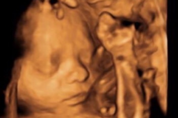 Fundraiser for Jessica Amundson by Lauren Barker : Baby Charlotte