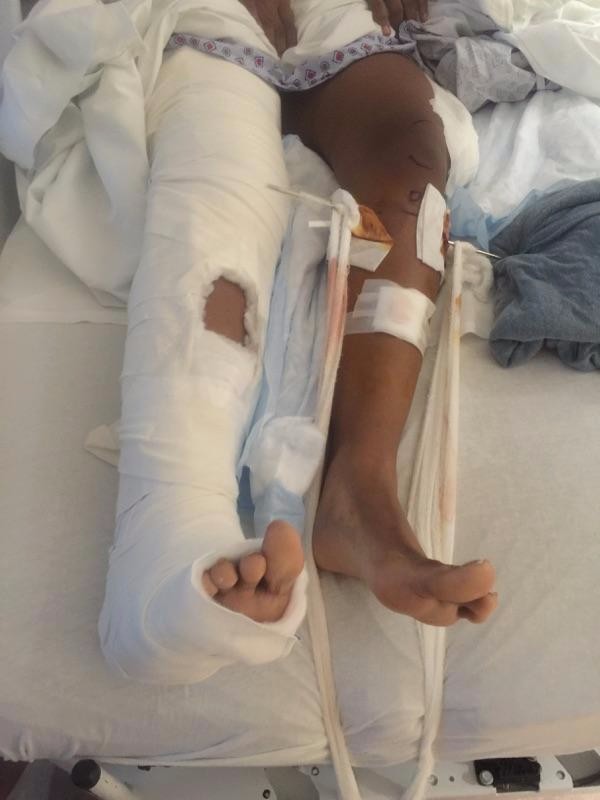 Fundraiser for Delane Hill by DeLane Slim Hill : Delane's Medical Fund