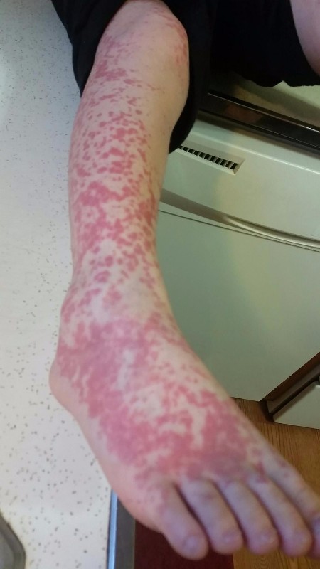 Fundraiser for Tiffney Hargrave by mari payne : HSP destroying this ...