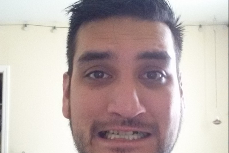 Fundraiser by Jacob Gabel : Help Jake fix his teeth!